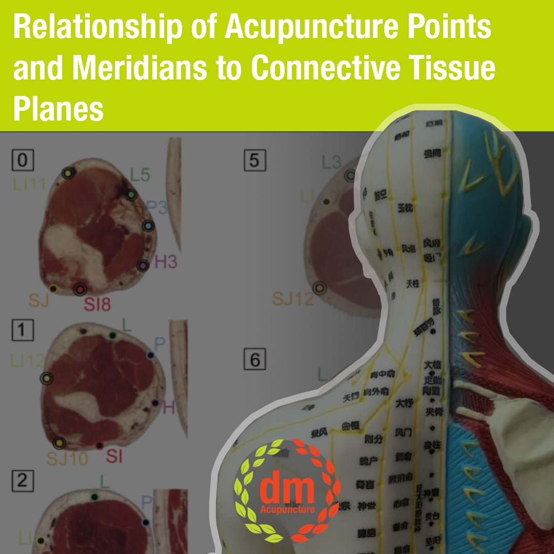 Meridians and Connective Tissue Planes | DM Acupuncture